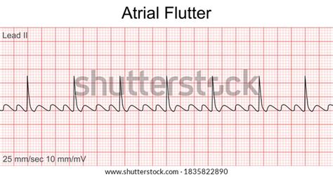 Flutter Stock Apobaseball