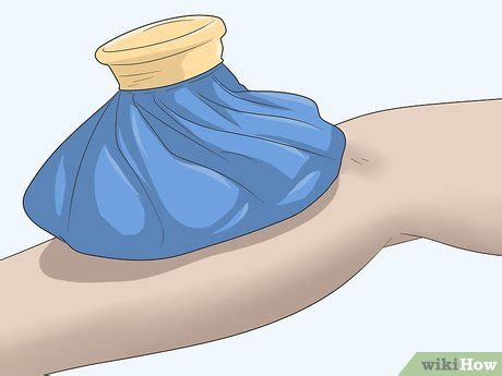 Simple Ways To Prevent Shin Splints When Running WikiHow Health