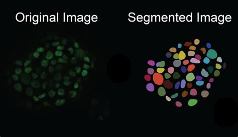 Cell Segmentation Image Eurekalert Science News Releases
