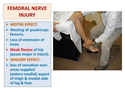 Ppt Sacral Plexus Femoral And Sciatic Nerves Powerpoint Presentation