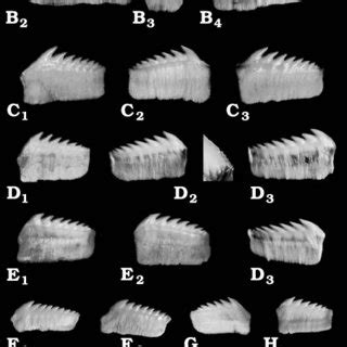 Overview Of Dental Variations In Lower Teeth Of Living Species Of