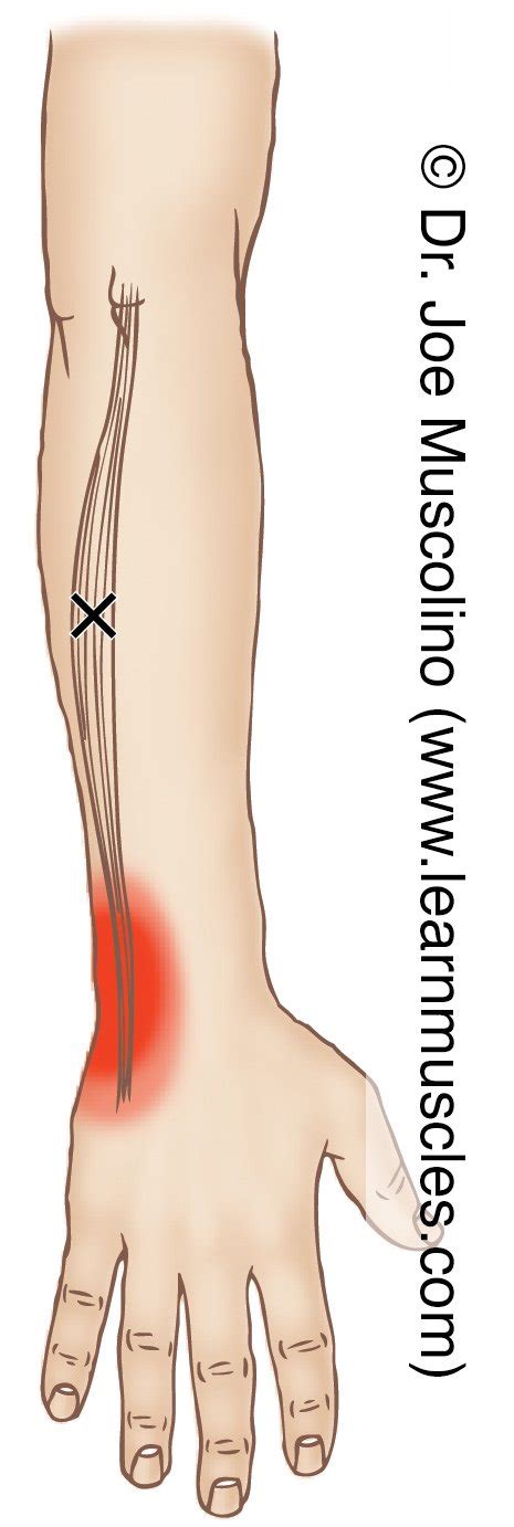 Extensor Carpi Ulnaris Trigger Points Learn Muscles