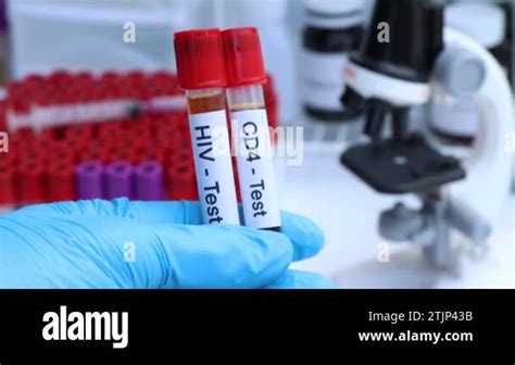 HIV Test And CD4 Test To Look For Abnormalities From Blood Blood Sample To Analyze In The
