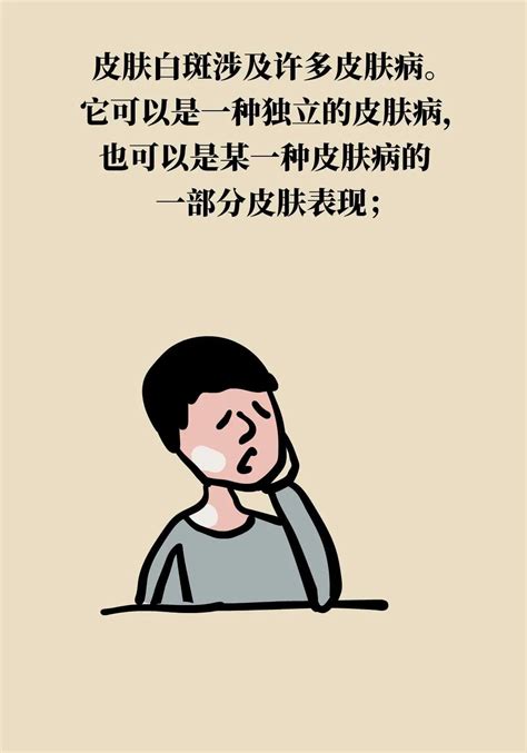 皮肤长了白斑就是白癜风 澎湃号湃客 澎湃新闻 The Paper
