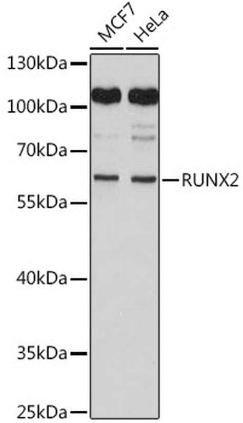 Runx2 Polyclonal Antibody Pa5 120837