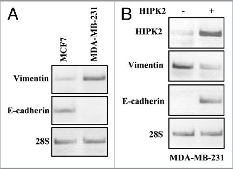 mrna expression of vimentin and e cadherin in breast cancer cells after