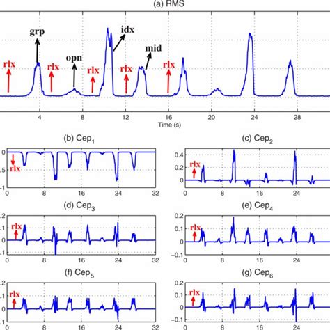 Myoelectric Control Scheme Involving A Missing Data Classification Download Scientific Diagram