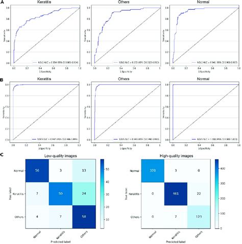 Performance Of The Ndls In The Internal Test Dataset A Receiver