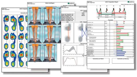 Zebris Medical Gmbh Dynamic Gait Analysis On The Treadmill