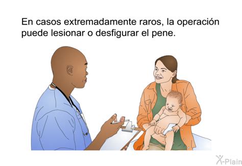 Circuncisión Pediatría