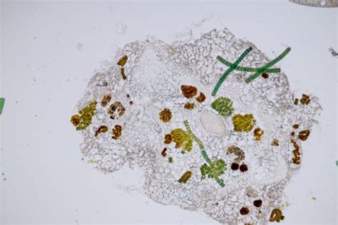 Protozoa And Plant Cells Under The Microscope For Education Stock Image Image Of Membrane