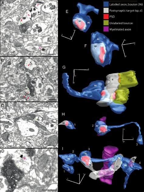 Prefrontal Pathways Synapsing In Superior Temporal Auditory Association Download Scientific