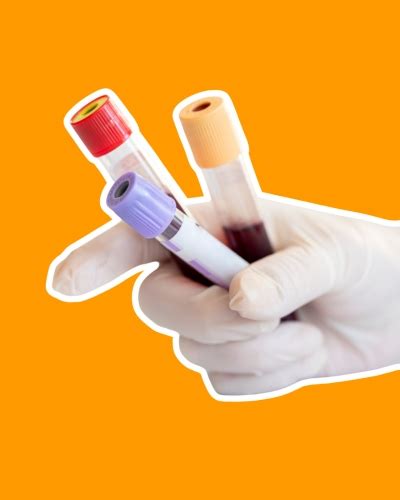 Top 10 Reasons To Get The AFP Tumor Marker Test Wittmer Rejuvenation Clinic