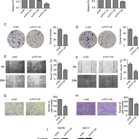 Downregulation Of Pvt1 Reduces Tumor Growth And Metastasis In Vivo A