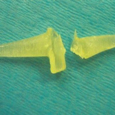 Abbreviations MCP Metacarpophalangeal Joint RA Rheumatoid Arthritis Download Scientific