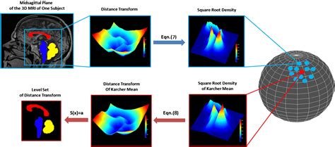 Figure 1 From Construction Of A Neuroanatomical Shape Complex Atlas From 3d Mri Brain Structures