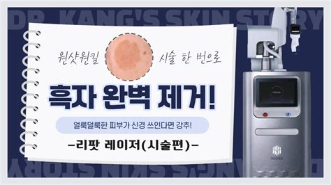 흑자검버섯 완전 정복 리팟레이저 시술편 Youtube