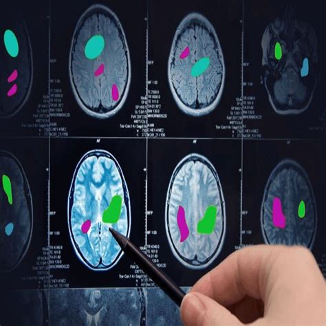 Ai In Healthcare Trends And Applications Datafloq