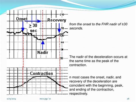 Ppt Ctg Powerpoint Presentation Free Download Id 6659650