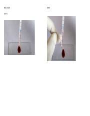 RBC COUNT Docx RBC COUNT STEP STEP STEP STEP STEP STEP