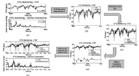 Computerized Ctg System Step By Step Block Diagram The Ctg Trace