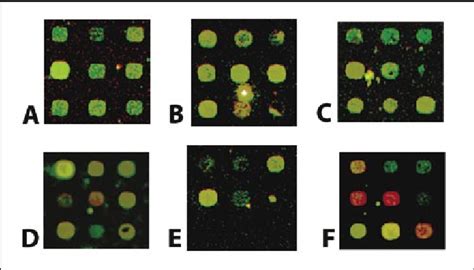 Microarray Spots For Which GenePix Estimates Of Log Ratios Are