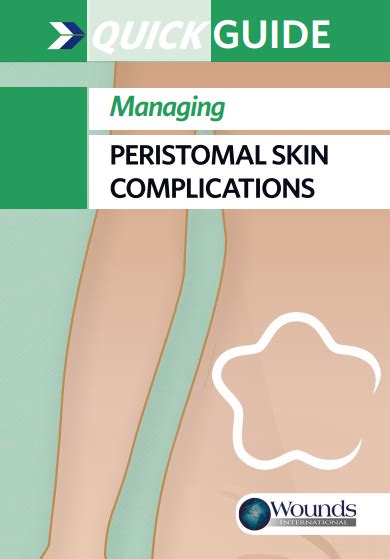 Managing Peristomal Skin Complications Quick Guide Wounds Asia