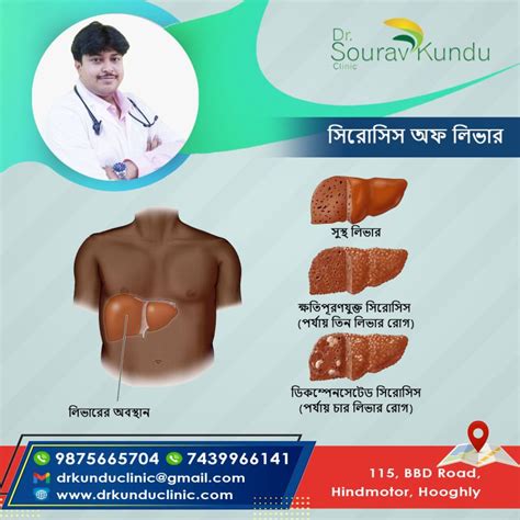 dr sourav kundu on linkedin cirrhosisliver healthylife