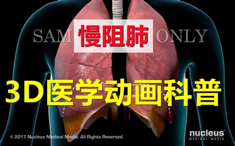 【3d医学动画科普】慢性阻塞性肺疾病（copd）（中英双语字幕） Bilibilib站无水印视频解析——yiuios易柚斯