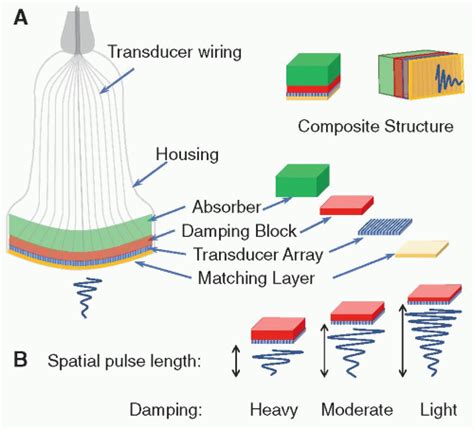 Ultrasound Radiology Key