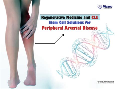 Stem Cell Solutions For Peripheral Arterial Disease