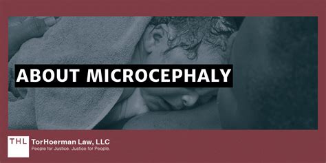 Camp Lejeune Microcephaly Lawsuit 2024 Update