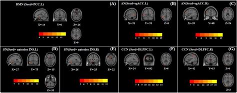 Dr Zohreh Majd On Linkedin Distinct Patterns Of Functional Brain