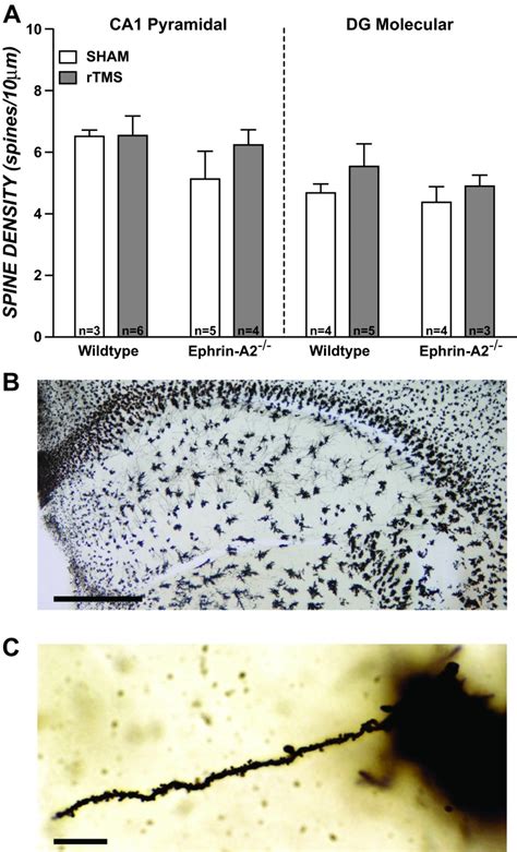 A Mean Dendritic Spine Density Number Of Spines Per 10 μm For