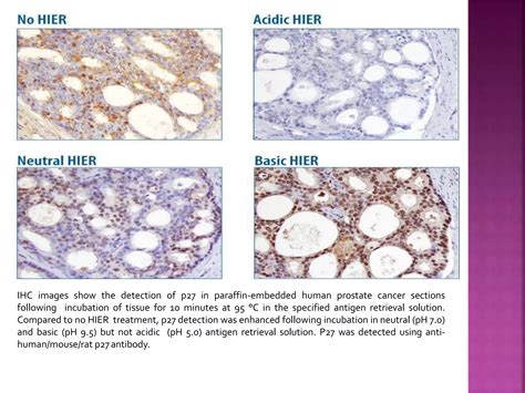 Antigen Retrievalpptx