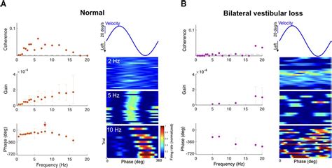 Vestibular Contributions To Primate Neck Postural Muscle Activity During Natural Motion