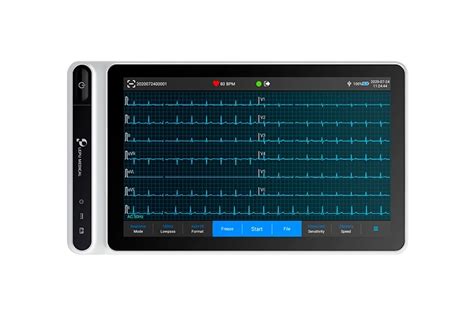 Lepu Medical Handheld Pcecg 500 Pocket Ecg Machine Portable 12 Lead