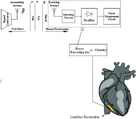 Architecture Of Wireless Power Transmission To Leadless Pacemaker In