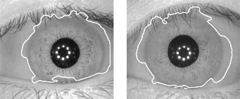 Figure 1 From Iris Segmentation Using Geodesic Active Contours Semantic Scholar