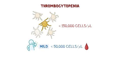 Approach To Bleeding Disorders Thrombocytopenia Clinical Sciences