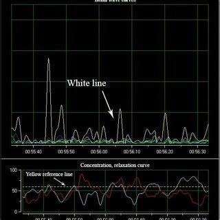The EEG Curve Relaxed Download Scientific Diagram
