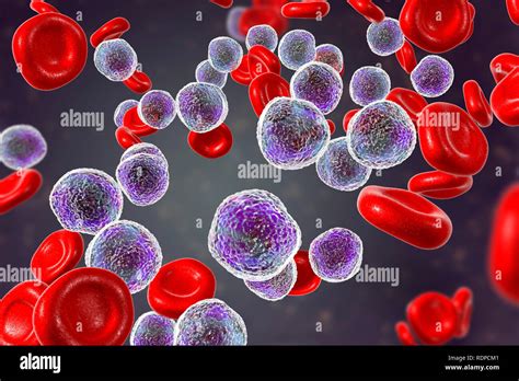 Acute Lymphoblastic Leukaemia Bone Marrow Smear Computer Illustration
