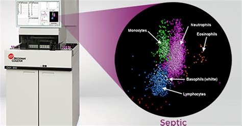 Monocyte Distribution Width Severity Of Infection Biomarker Selectscience