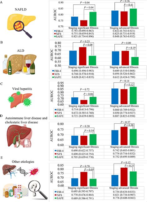 The Steatosis Associated Fibrosis Estimator Safe Outperformed The Fib
