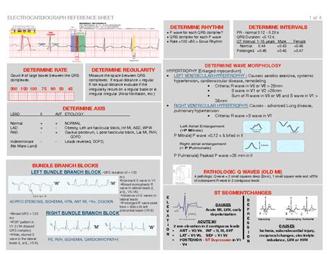 Ecg Box Counting Rate At Bill Gilmore Blog