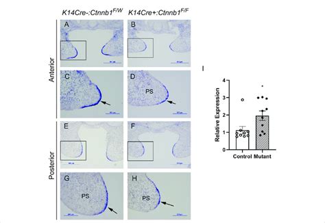 Mee Specific Tgfb3 Expression Does Not Differ Between Control And Download Scientific Diagram