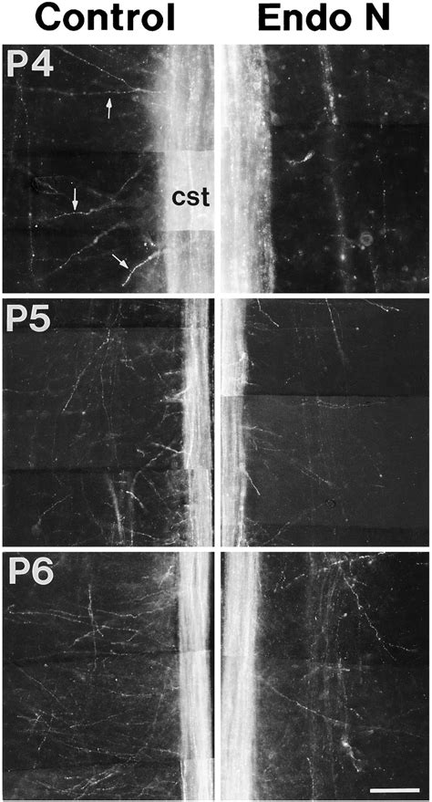 Removal Of Psa Delays And Reduces Collateral Branching Along Download Scientific Diagram