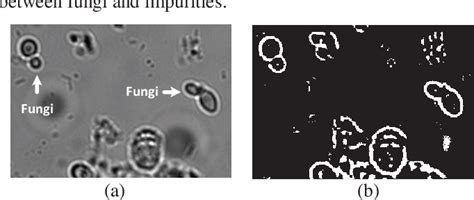 Figure 1 From Automatic Detection Of Fungi In Microscopic Leucorrhea