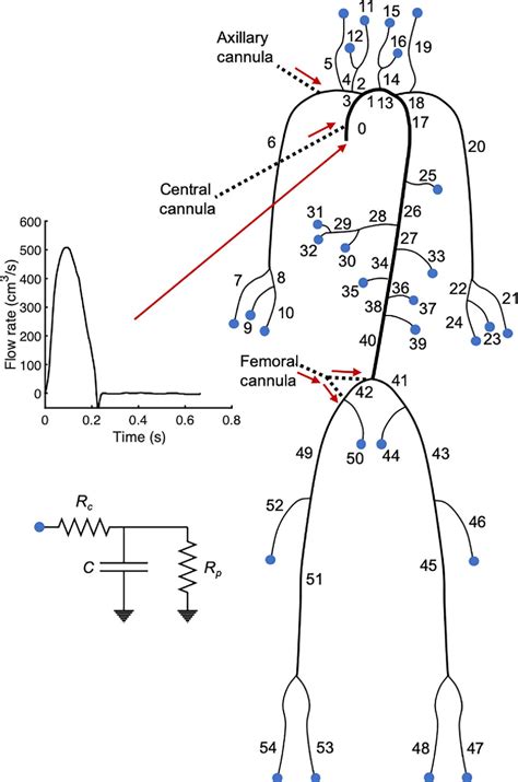 Figure From Determining The Impacts Of Venoarterial Extracorporeal