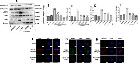 Inhibition Of Ddr1 And Ddr2 Expression Prevents Progression Of